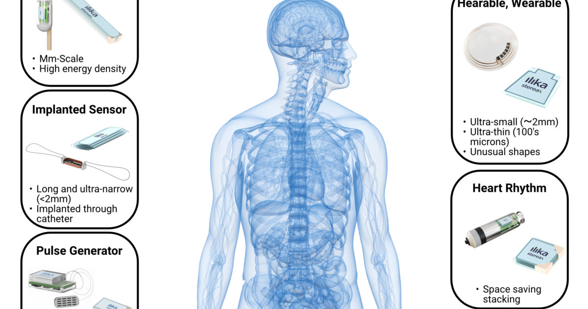 Solid State Batteries for Next-Generation Medical Devices | Ilika